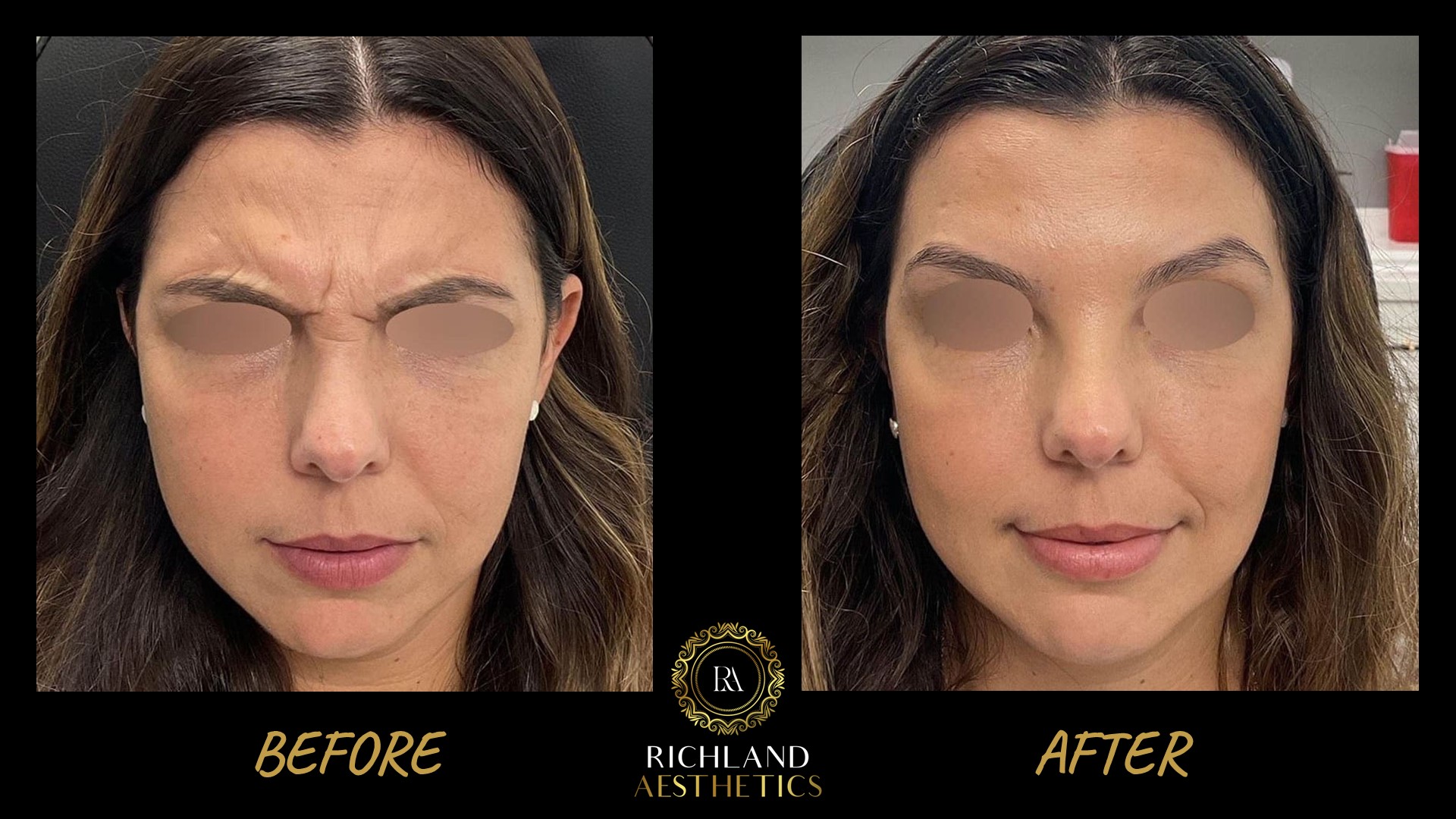 Weight Loss - Richland Aesthetics