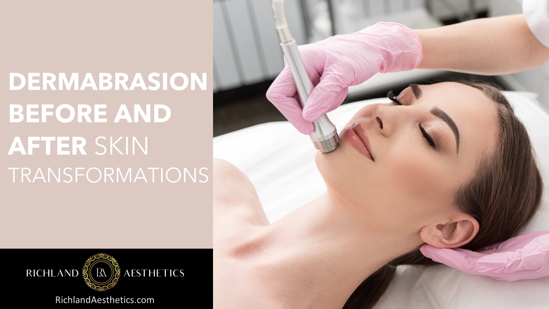 Dermabrasion Before and After Skin Transformations - Richland ...