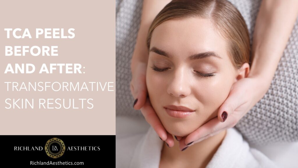 TCA Peels Before and After: Transformative Skin Results - Richland ...