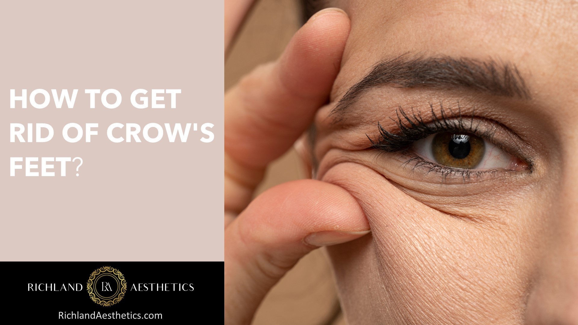 How to Get Rid of Crow's Feet? - Richland Aesthetics Luxury Med Spas