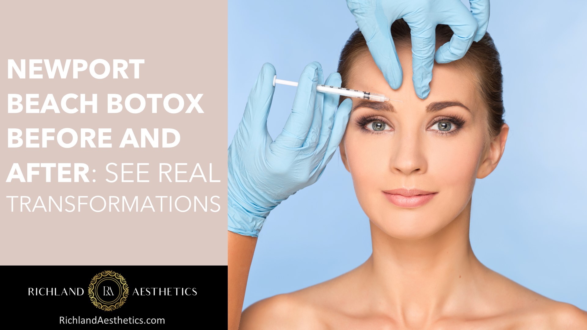 Newport Beach Botox Before and After: See Real Transformations - Richland Aesthetics Luxury Med Spas